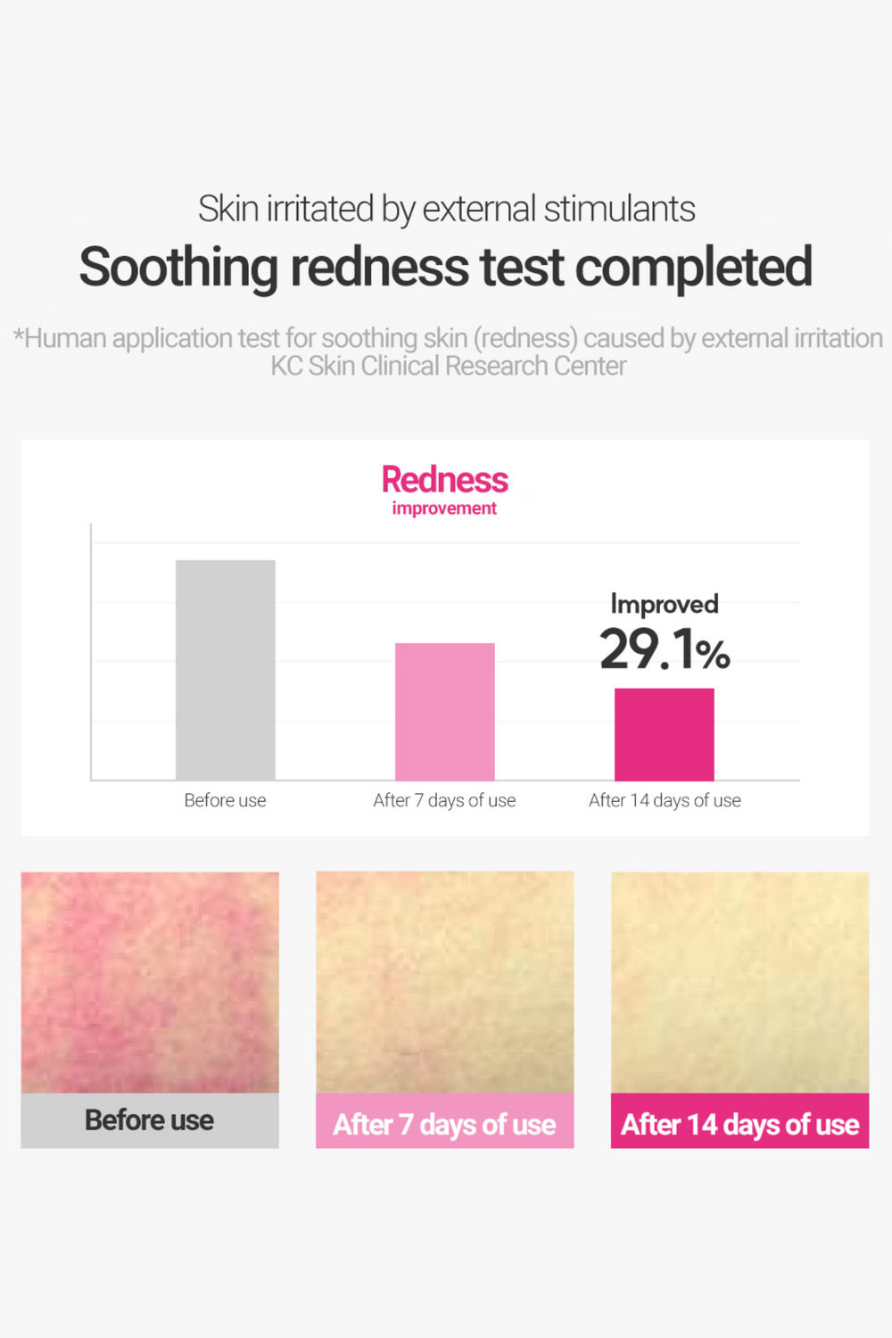 Cica Care Blemish Clearing Cream