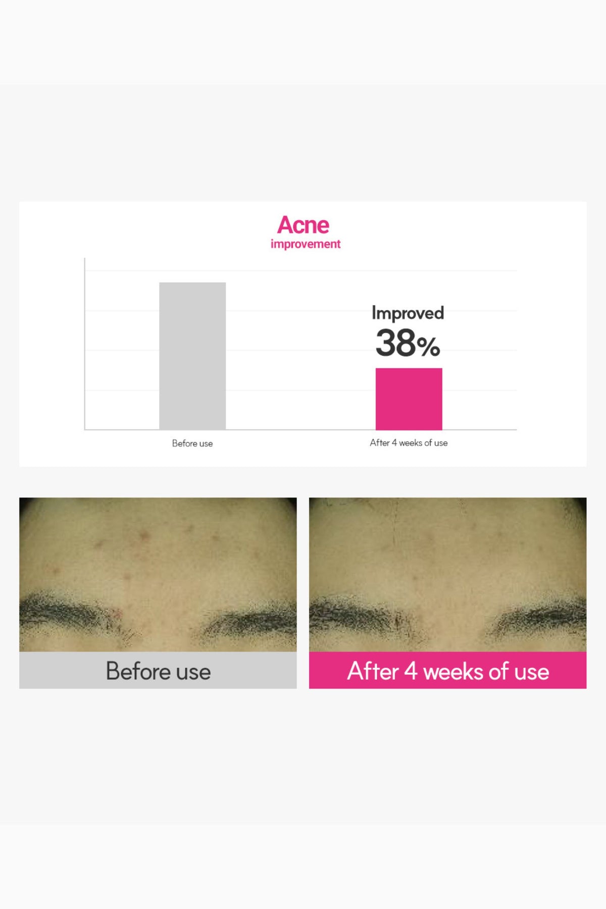 Cica Care Blemish Clearing Cream